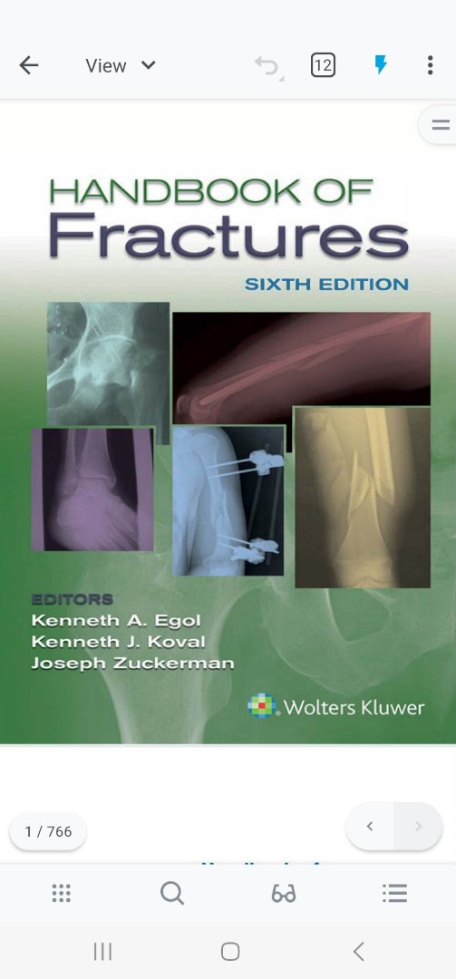 HANDBOOK OF FRACTURES ORTHO, Hobbies & Toys, Books & Magazines ...