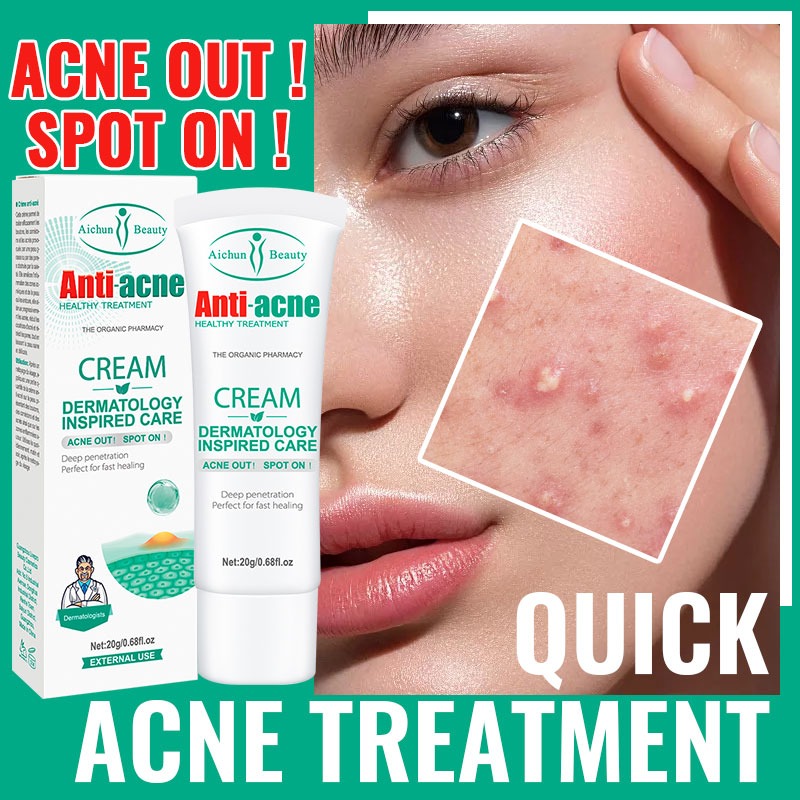 Anti Acne Cream Pimple Remover Cream Acne Treatment Acne Scar Remover ...