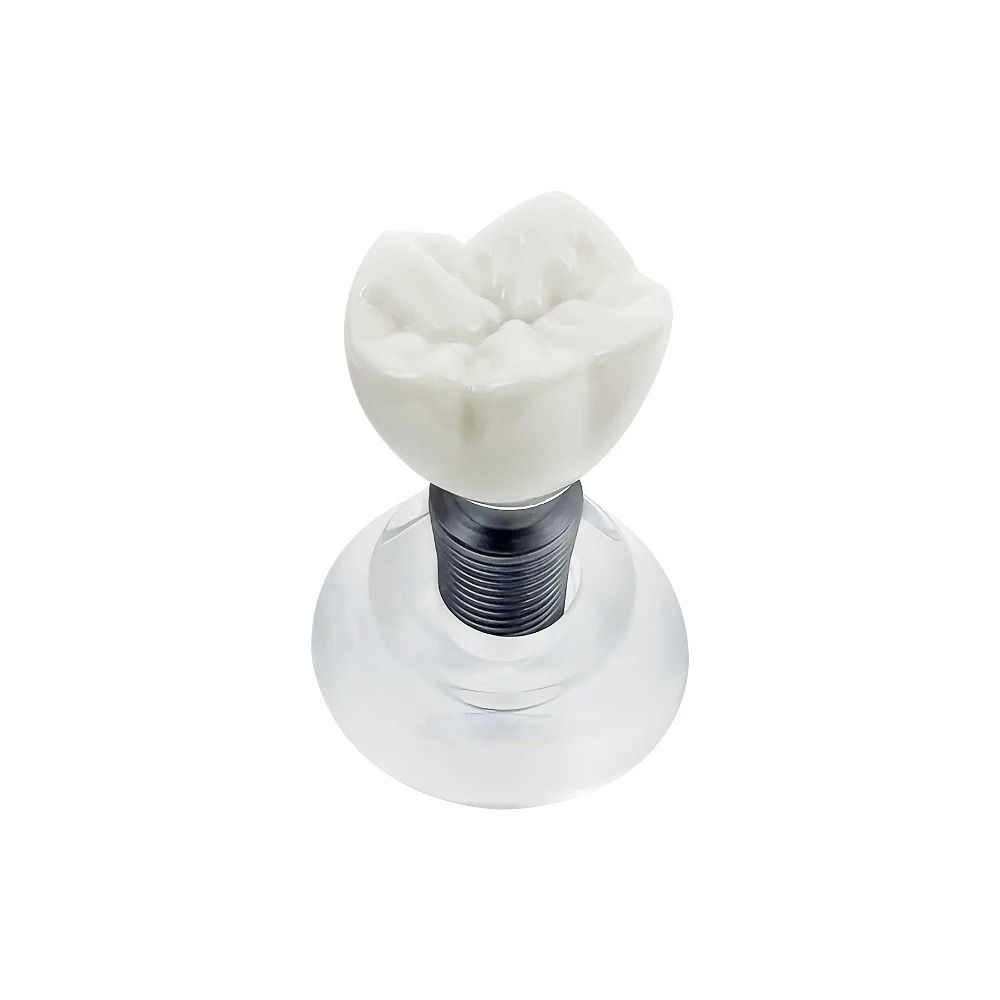 Clear Implant Denture Model Crystal Dental Implant Teeth Model Crown ...
