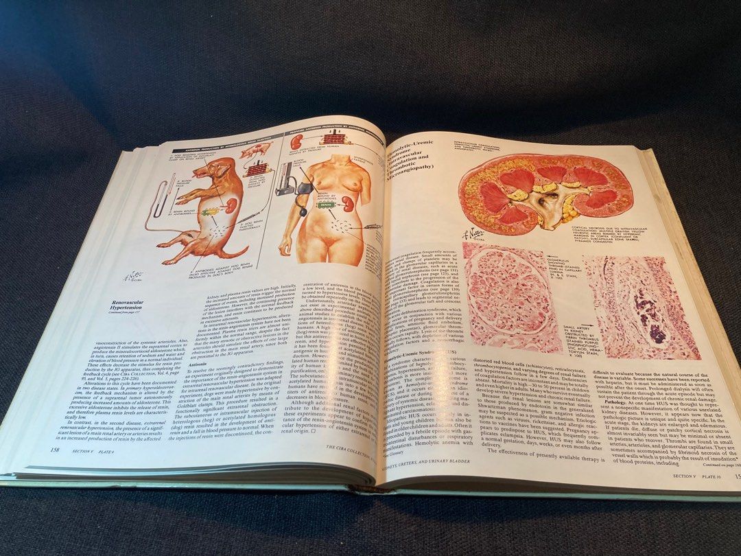 二手書 THE CIBA COLLECTION OF MEDICAL ILLUSTRATIONS VOLUME 6 KIDNEYS ...