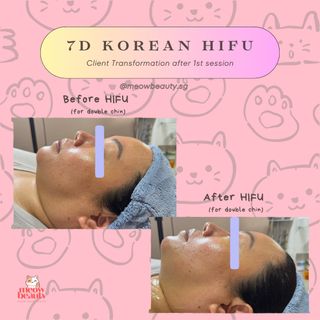 M14 Pro Collagen Pao Home Beauty Device Instant Face V-Lifting and ...
