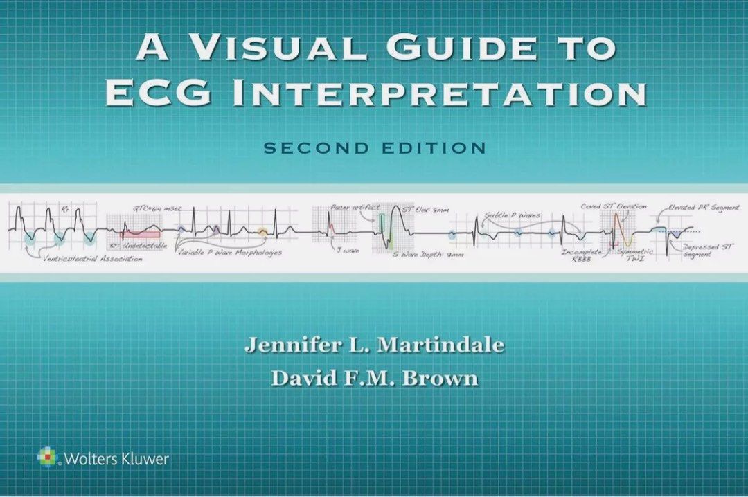 A visual guide to ECG interpretation - ECG made easy, medicine, Hobbies ...
