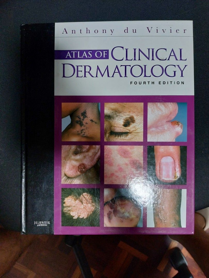 Atlas of clinical dermatology by Anthony du Vivier, Hobbies & Toys ...