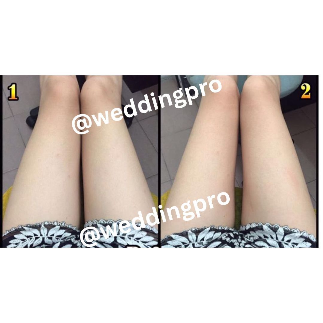 🇯🇵全場最平‼️Svelty V面美顏美腿丸 💯有效瘦小腿 增肌減脂 水腫 去水丸 消水丸 減重 減體脂 溶脂 虛肥 包包臉 懶人瘦身 新陳代謝 燃脂 滅脂 消脂 瘦臉 瘦面 酵素 益生菌 瘦 ...