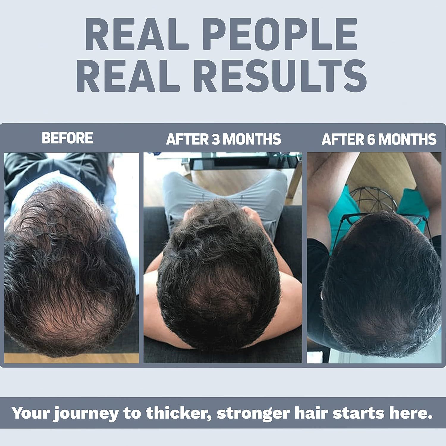 Herbtonics Foli-Tonic DHT Blocker To Stop Hair Loss Hair Thinning ...