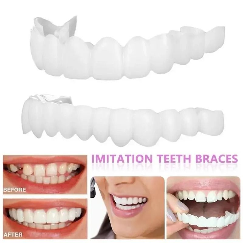 Sdatter Snap On Teeth Veneers Dentures For Men And Women Cover The ...