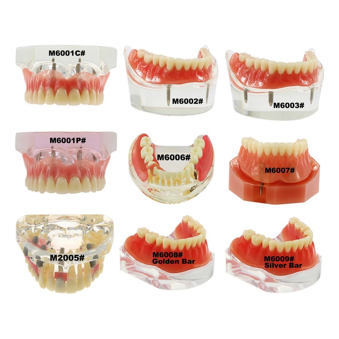 Dental Standard Teeth Model Practice Implant Restoration Disease ...