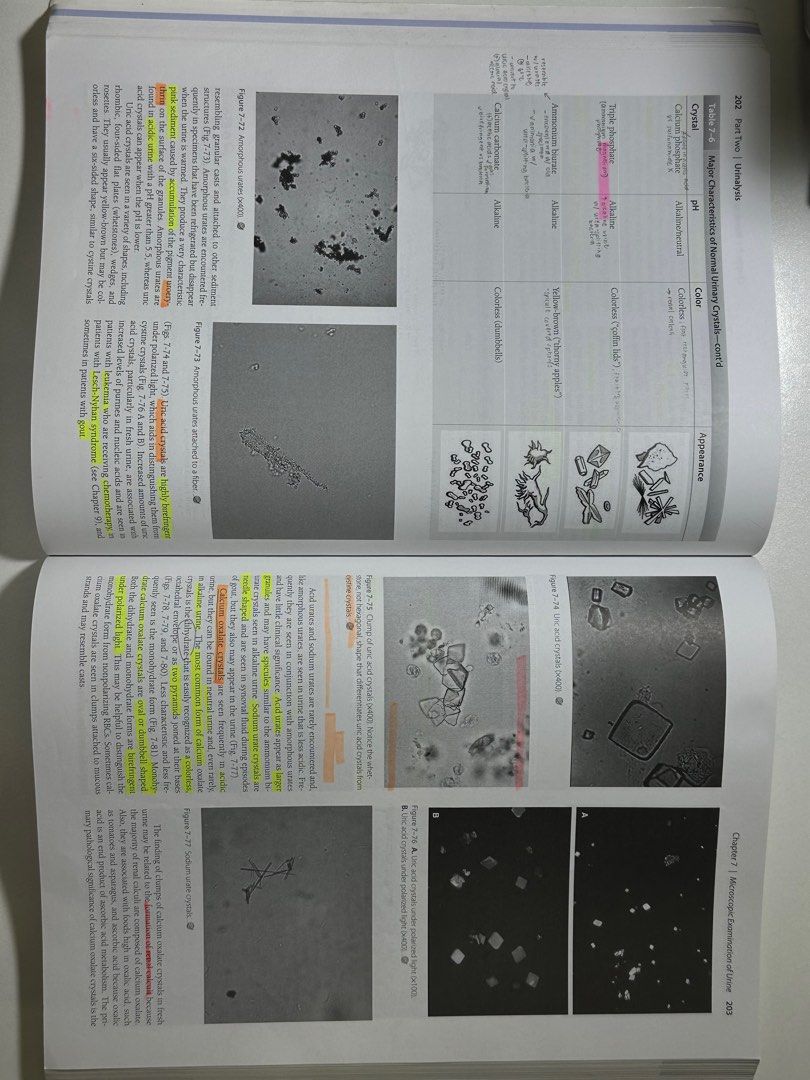 Urinalysis and Body Fluids by Strasinger—7th edition, Hobbies & Toys ...