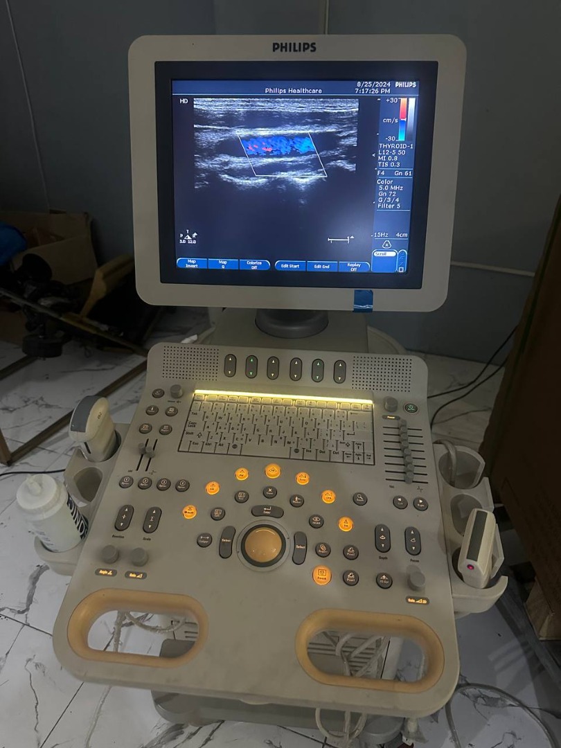 Philips Ultrasound, Computers & Tech, Office & Business Technology on ...