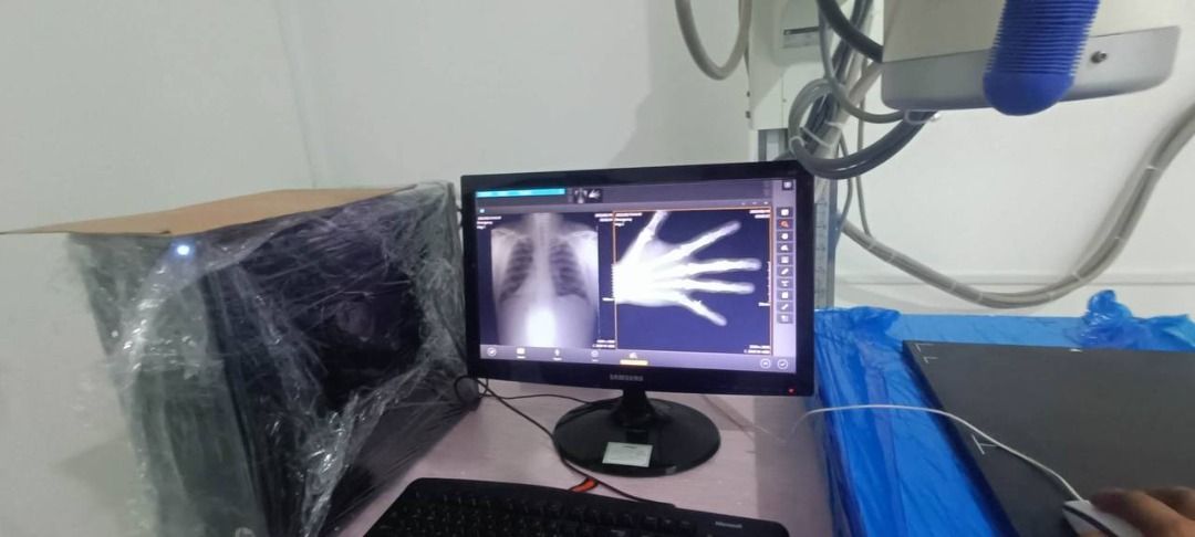 CR for X-ray digital system for sale Fuji cr prima 2 With digitizer ,pc ...