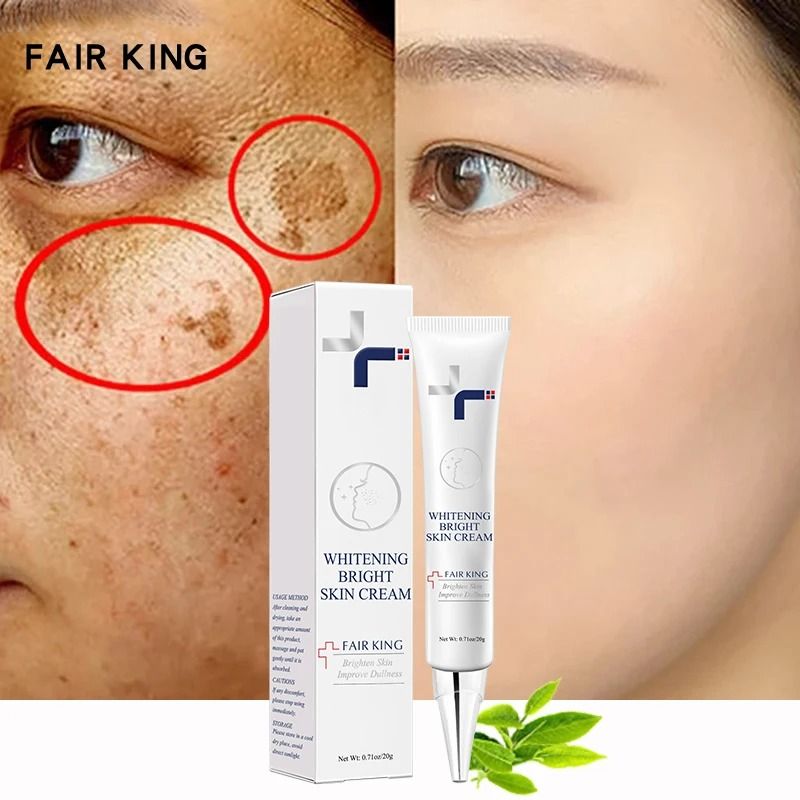 Dark Spot Corrector Skin Whitening Fade Cream Lightening Blemish Removal Serum Reduces Age Spots ...
