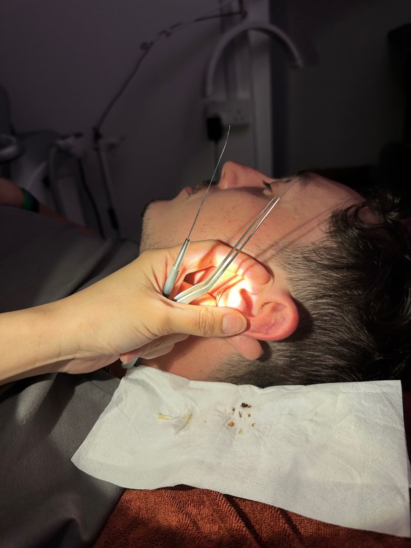 Ear wax removal, Beauty & Personal Care, Ear Care Products on Carousell