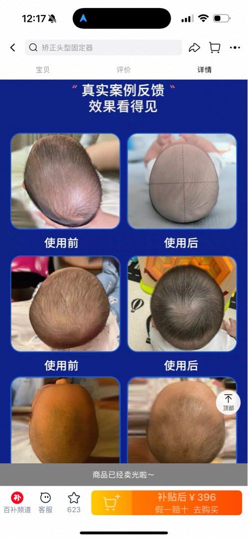 Baby Head Shaping Hat - 0-6 Months, Babies & Kids, Babies & Kids ...