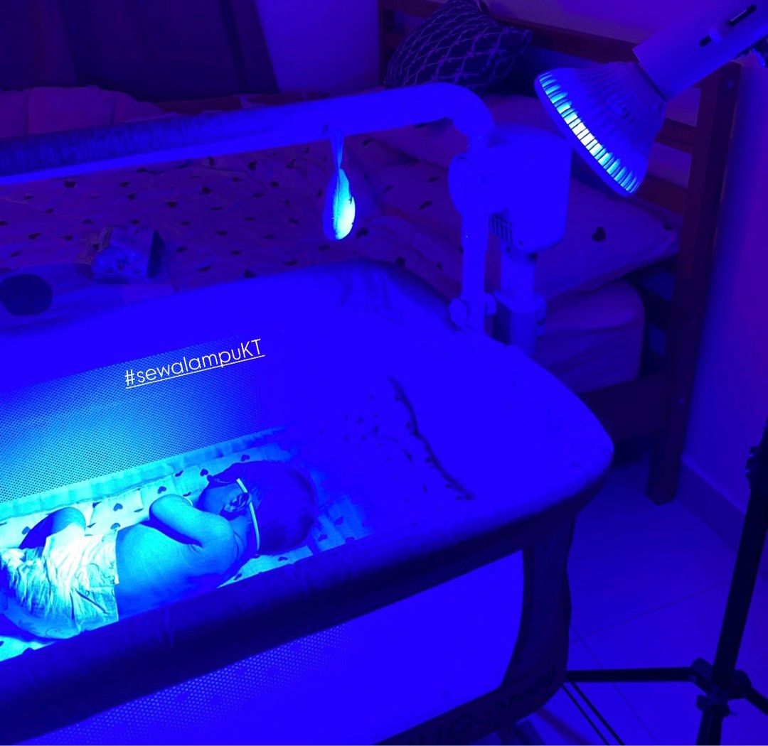 Sewa Lampu Jaundice, Babies & Kids, Baby Monitors on Carousell