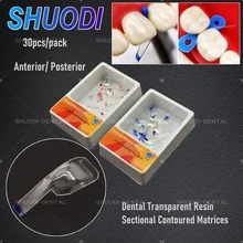 30 Pcs/box Dental Transparent Sectional Contoured Matrices Matrix ...