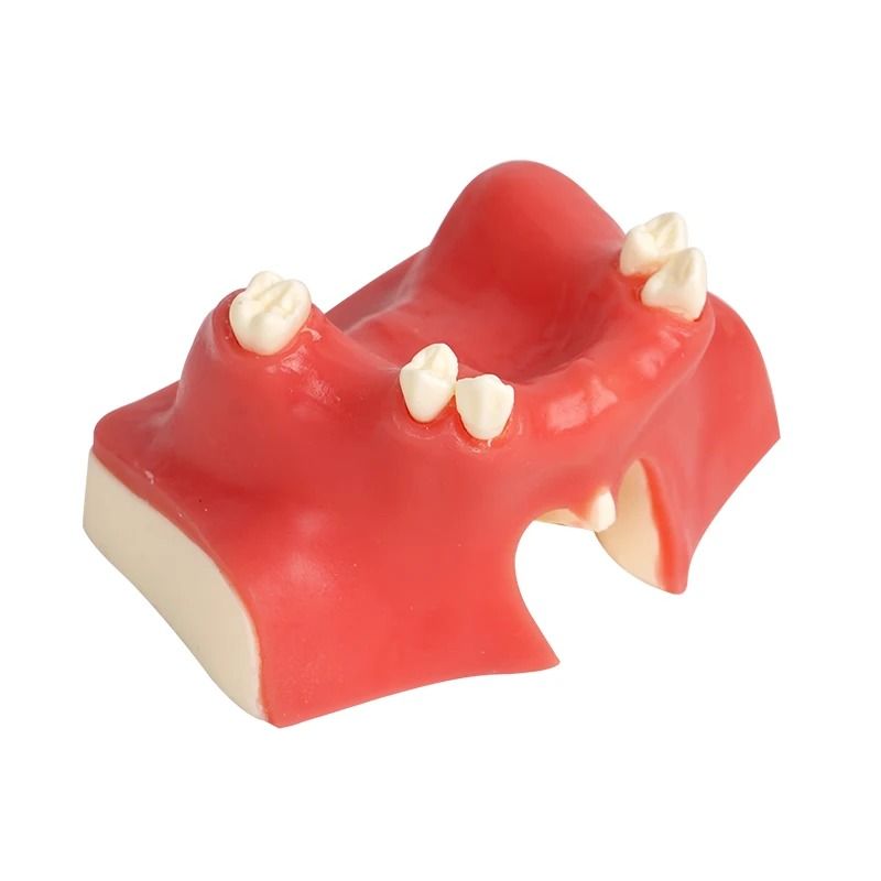 Dental Implant Teaching Model Upper Jaw Maxillary Sinus Model Teeth ...