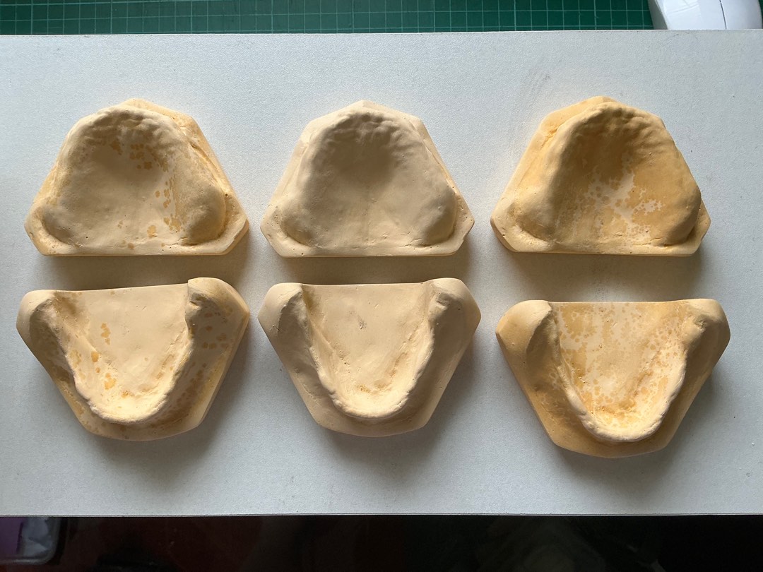 CD Complete Denture Edentulous Casts, Health & Nutrition, Medical ...