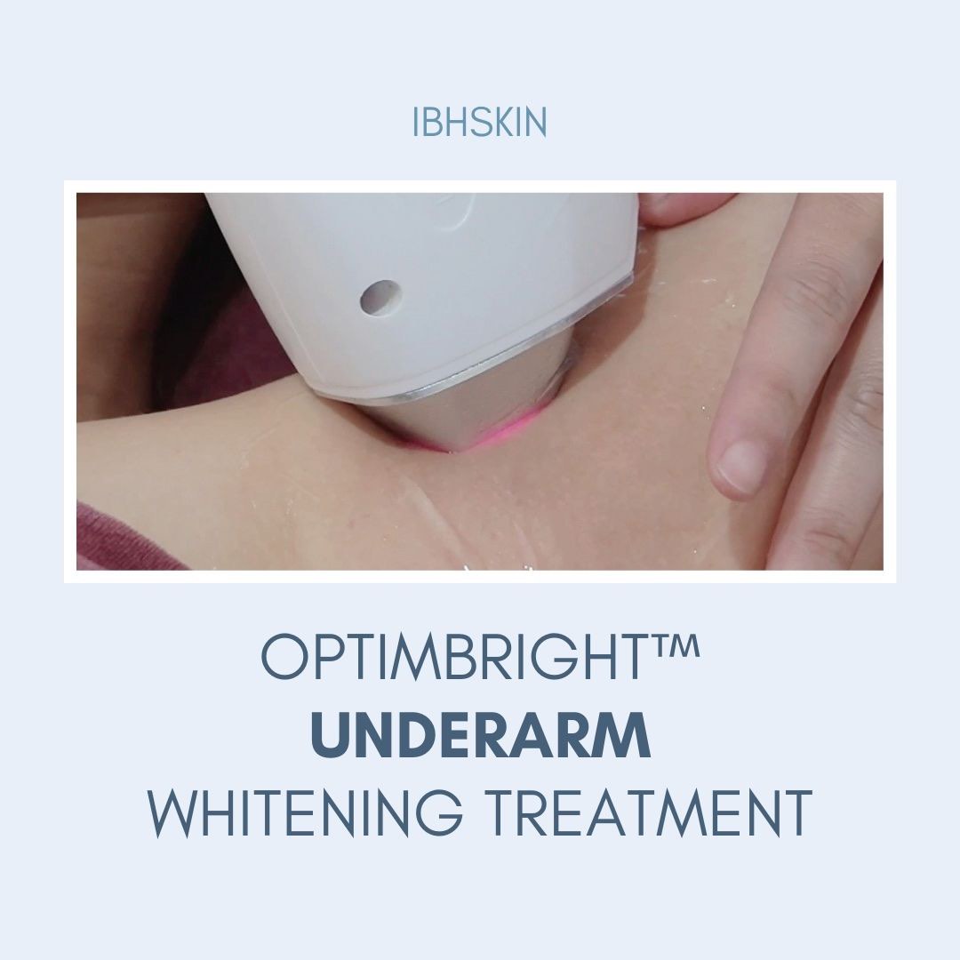 Underarm whitening treatment & Oligo repair, Lifestyle Services, Beauty ...