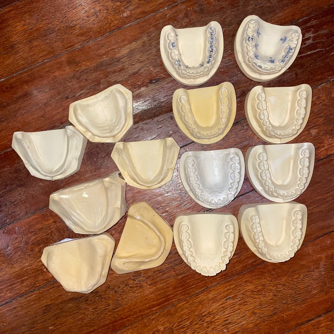 Edentulous and dentulous casts for practice | Prostho Dental Materials ...