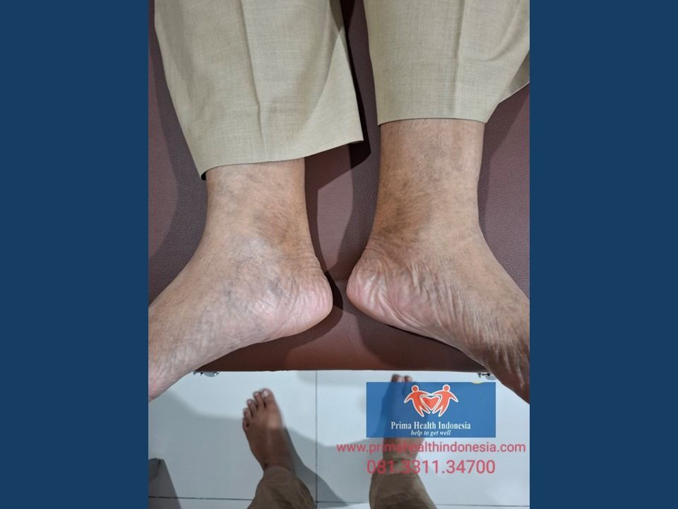 Telp 081 3311 34700 Tempat Pengobatan Sakit Lambung Alami Tanpa Efek ...