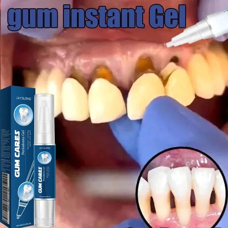 Rapid Repair Damaged Gums Gel Serum Relieve Sore Tooth Allergy Dental ...