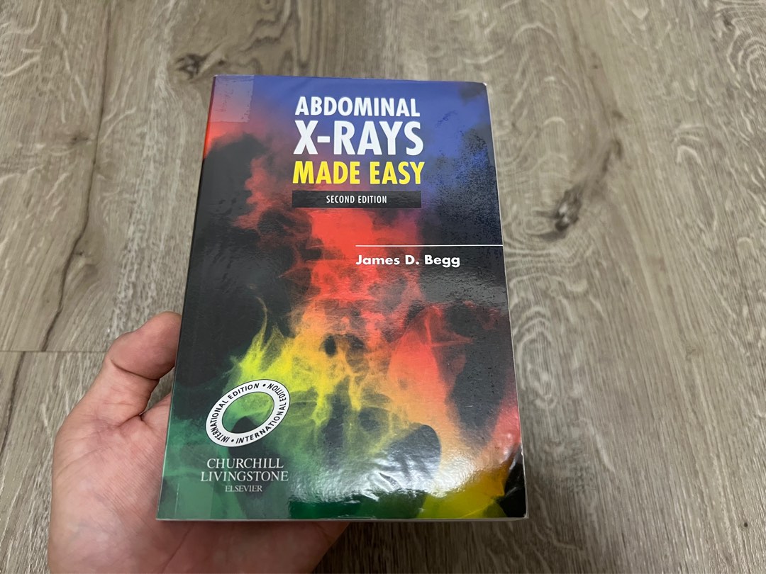 Abdominal X-Rays Made Easy, Second Edition, Hobbies & Toys, Books ...