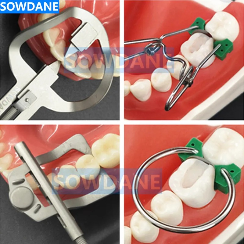 1 set Dental Tooth Teeth Separator Divider Wedge Retainer Anterior ...
