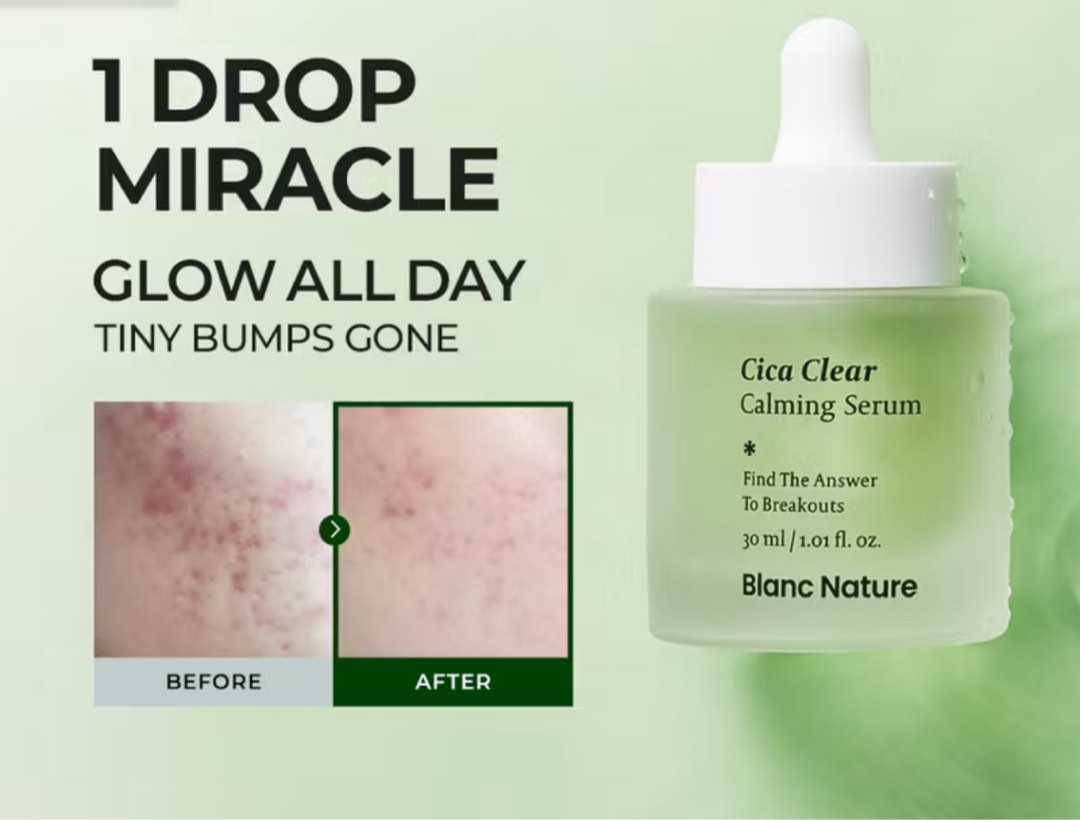 Quick Acne Removing Serum 30ml | Intensive Soothing & Hydrating Formula ...