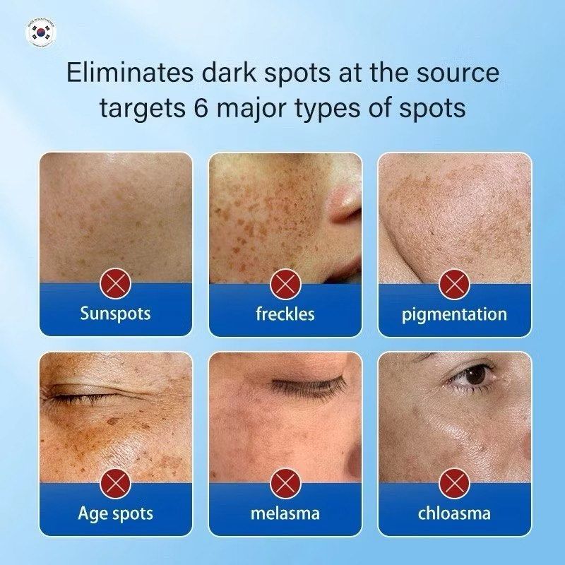 Dr. Ville Whitening Cream 5-Links - Spot Removal, Beauty & Personal ...