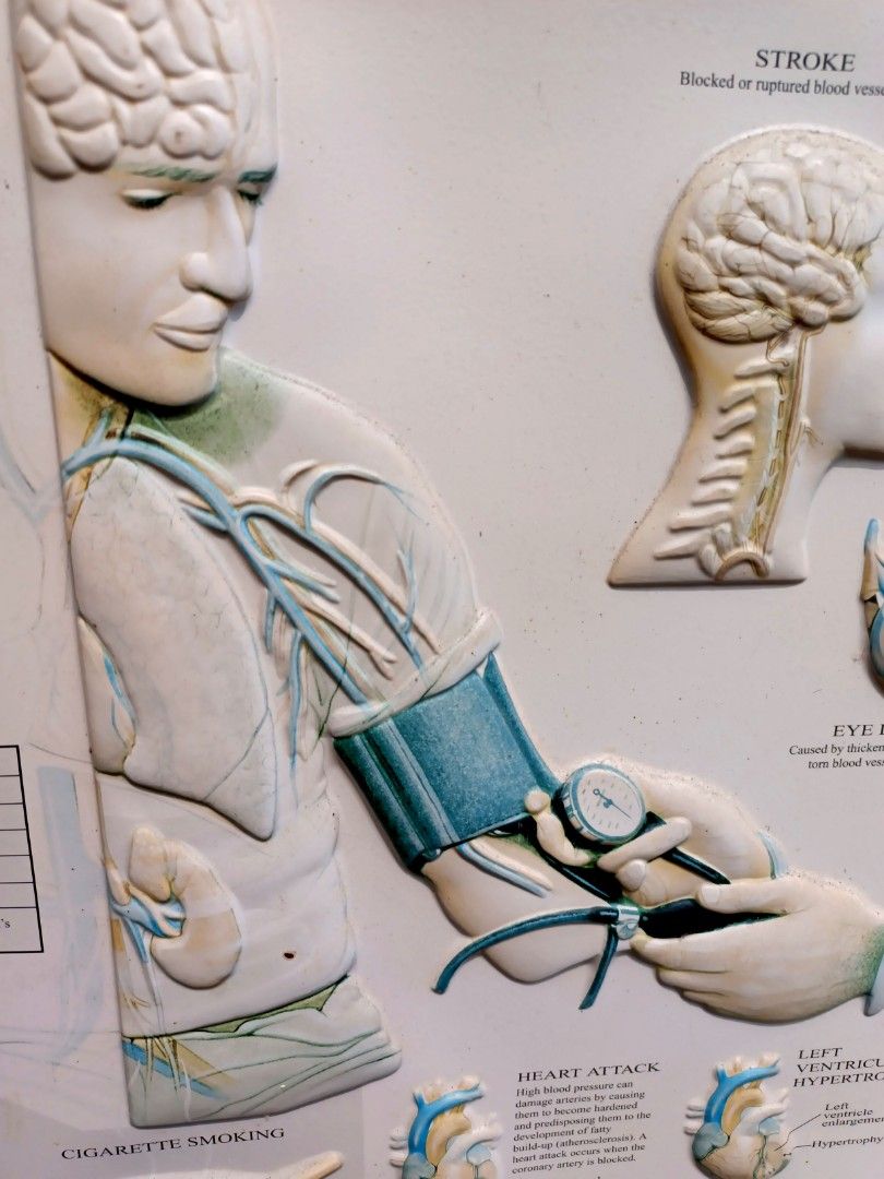 Vintahe Anatomy Poster Chart Risk Of High Blood Pressure, Health ...