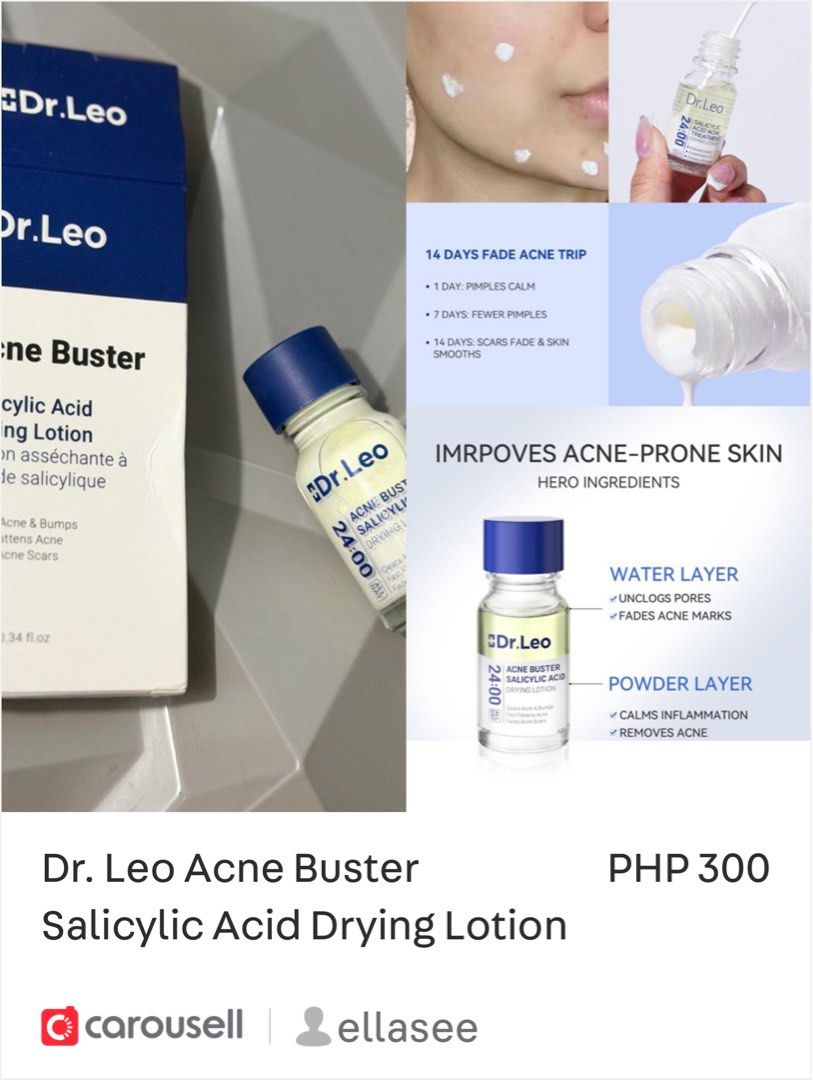 Dr. Leo Acne Buster Salicylic Acid Drying Lotion, Beauty & Personal ...
